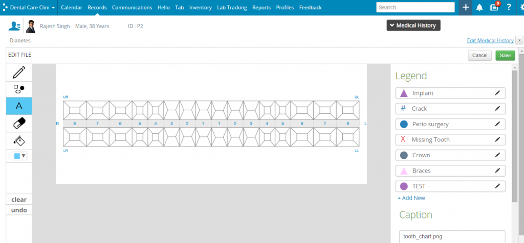 All About Dental Charting – Practo Help